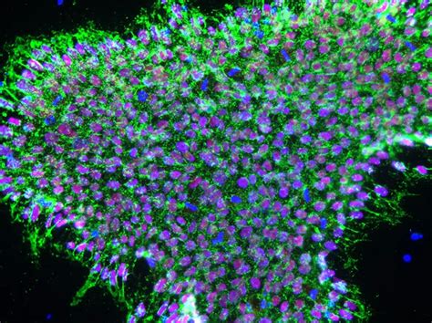 NIH Suspends New Embryonic Stem Cell Line Submissions – Clever Journeys